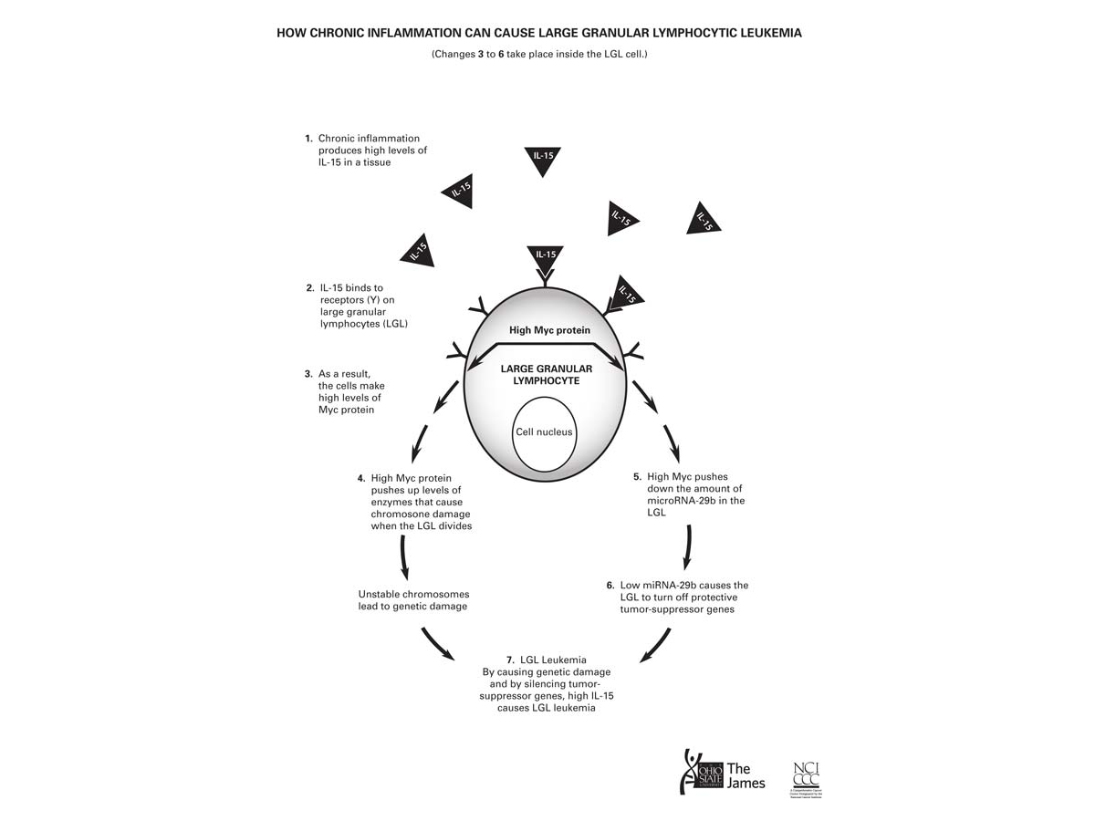 Study Shows How Chronic Inflammation Can Cause Cancer