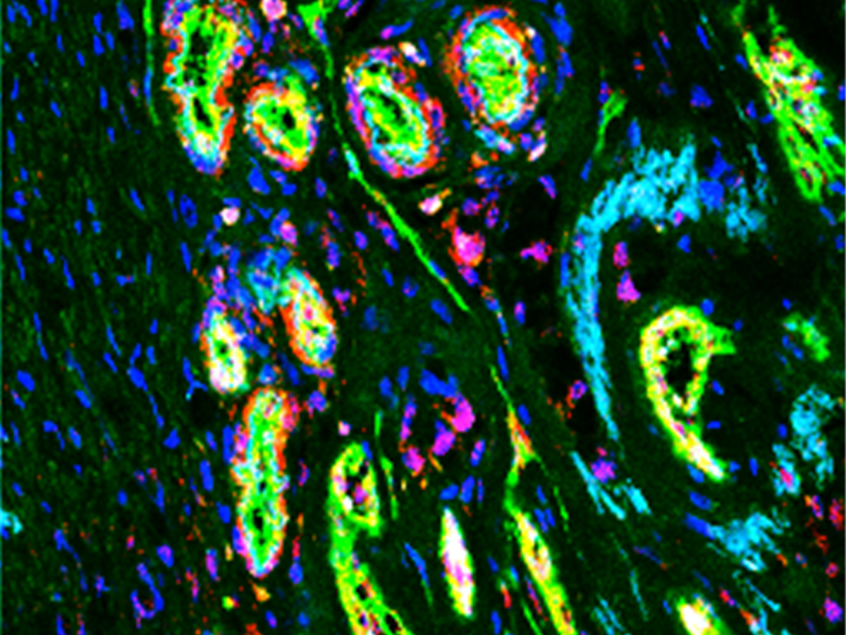 Study identifies new molecular target for cancer therapy