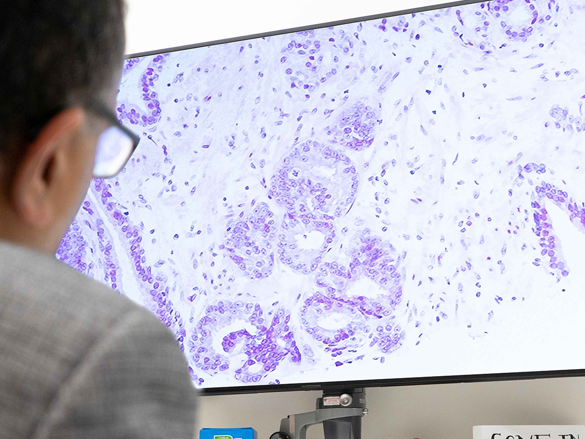 AI tools see beyond the human eye to better diagnose cancer