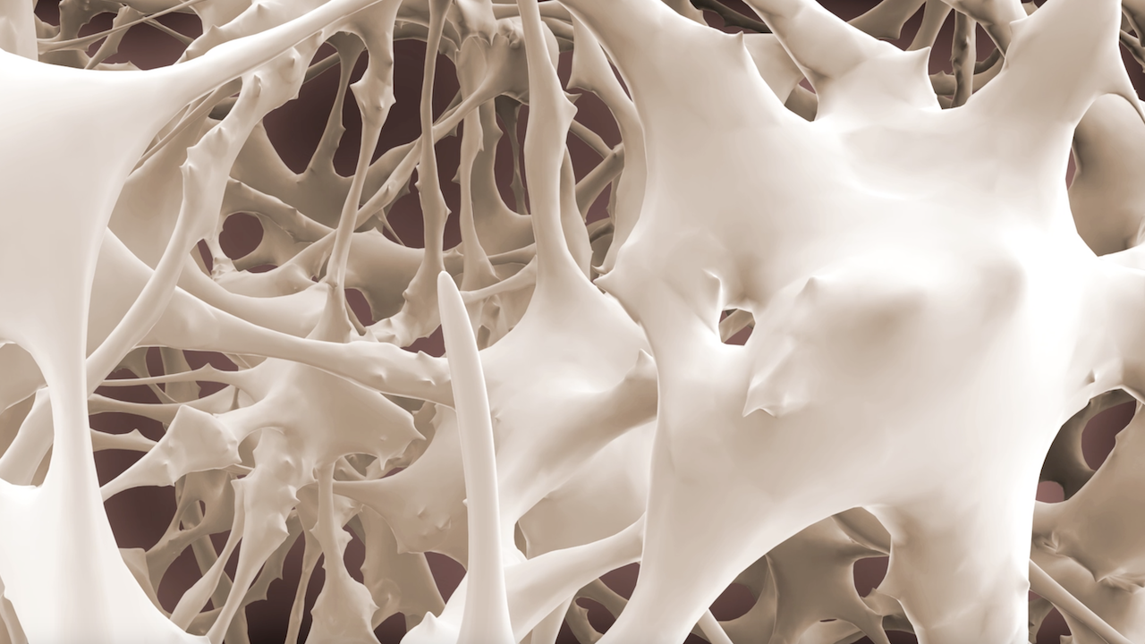 What you need to know about sarcoma, including symptoms and treatment