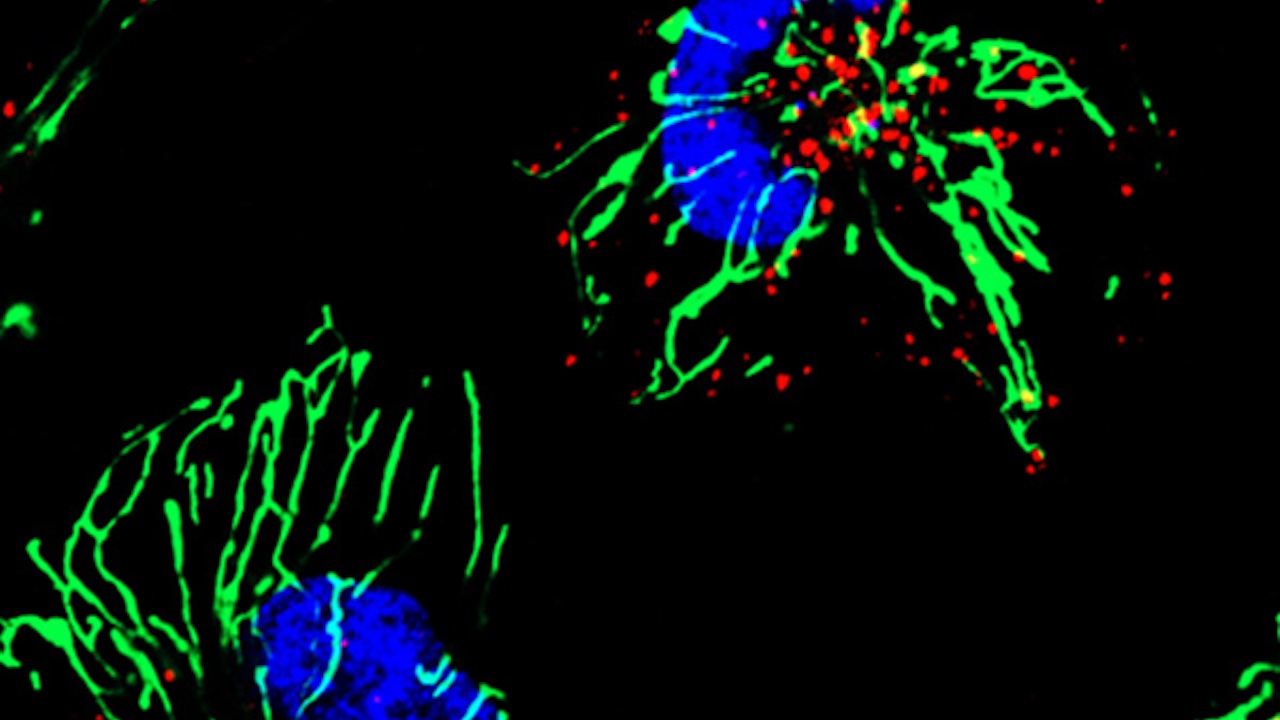 Ohio State leads study of promising new brain cancer treatment