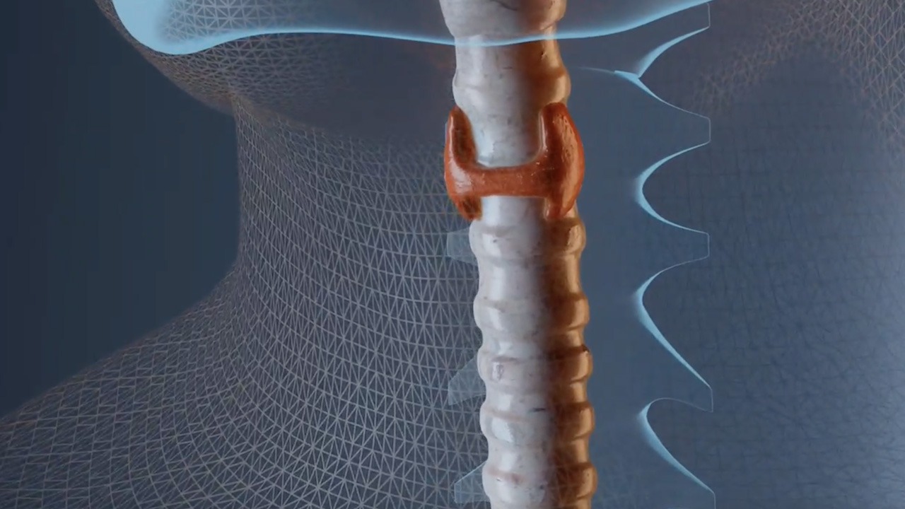 Ohio State researchers studying new treatment for rare thyroid cancer