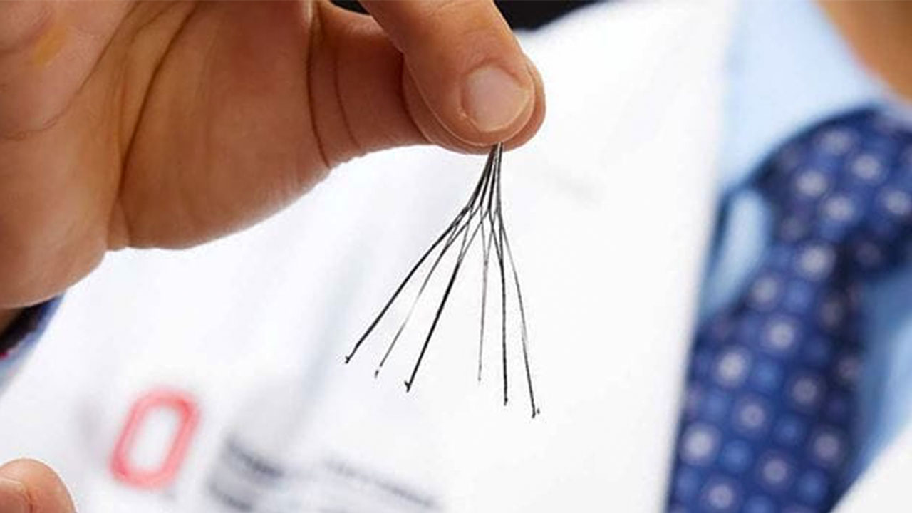 Why interventional radiology is becoming a core component of cancer care