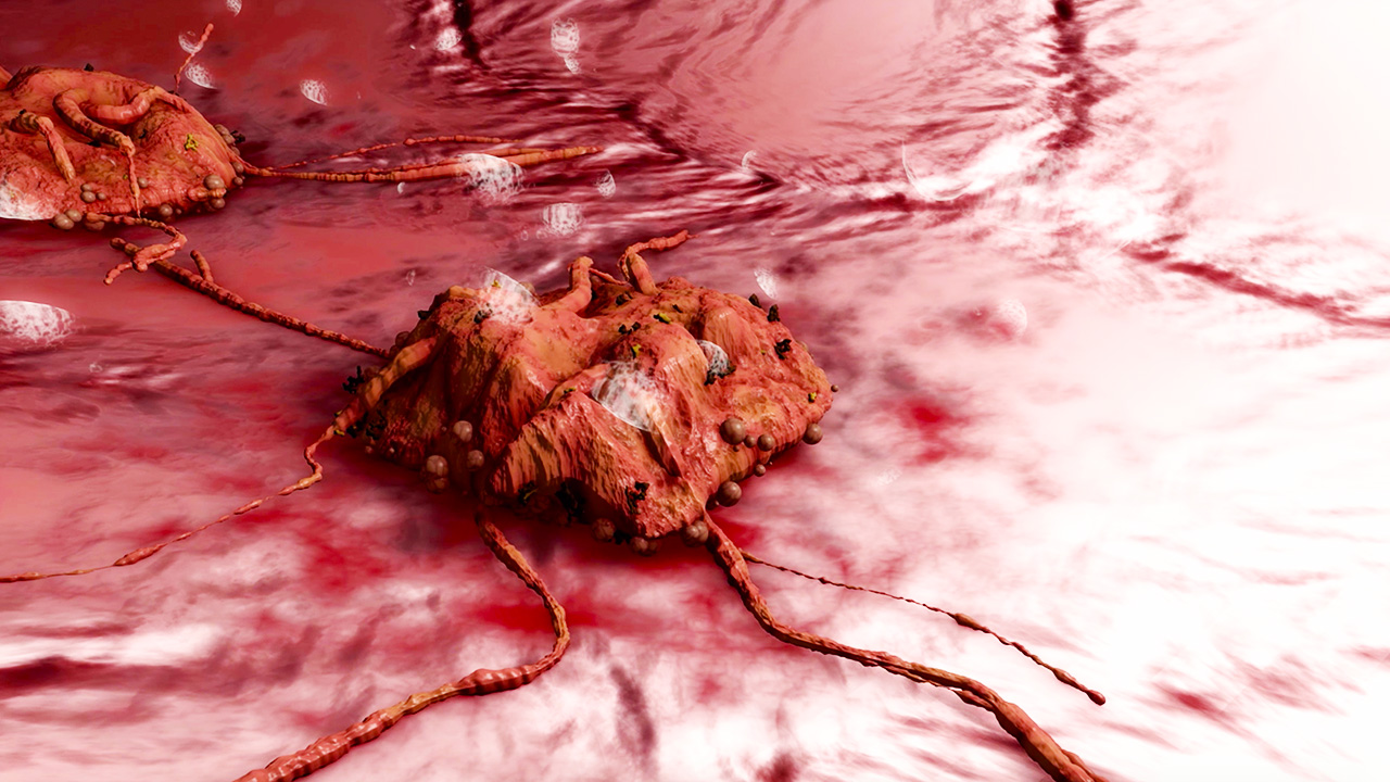 Fluorescent treatment lighting the way to better cancer surgeries at ...