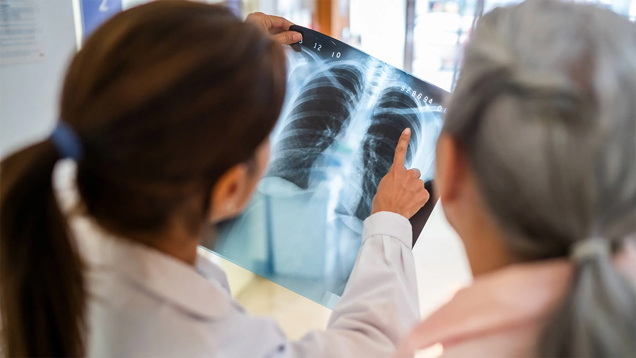 Why lung cancer research is so important